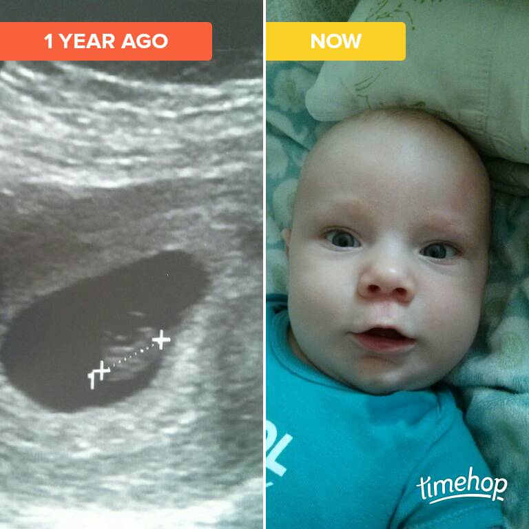 One year ago today... - Real And Quirky